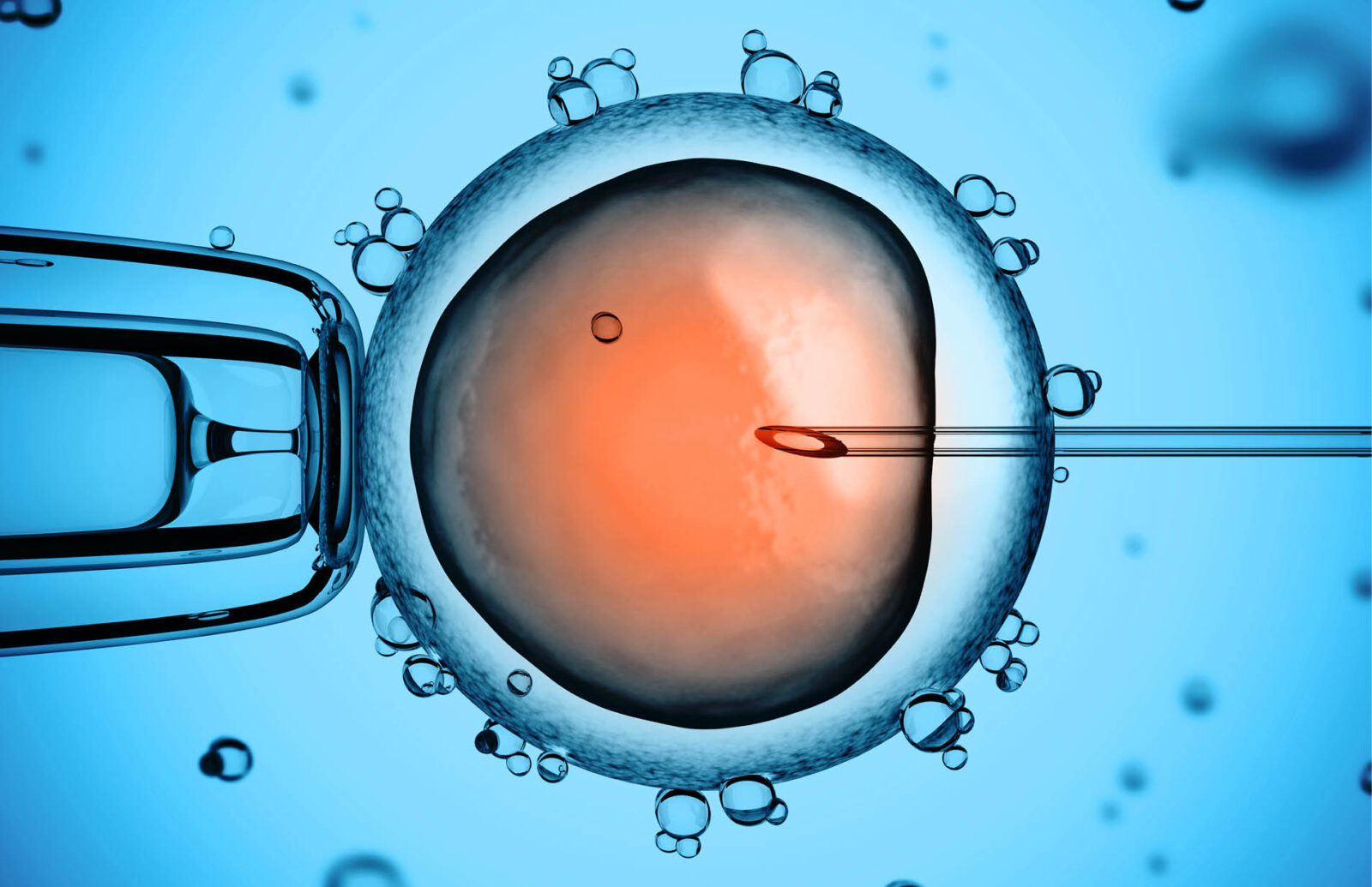 Inseminação Artificial Como Funciona Mulher E Gestação